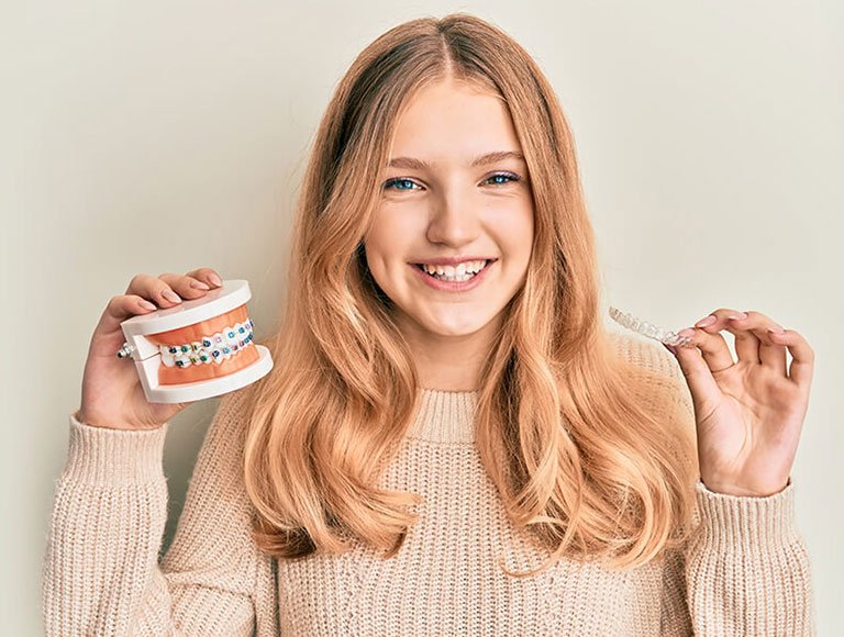 Invisalign — The Invisible Alternative To Traditional Braces ...