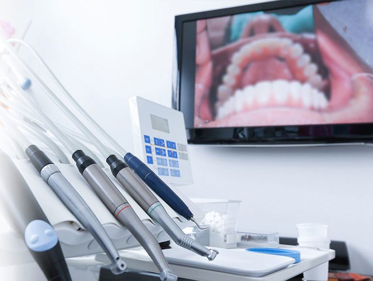 iTero Intraoral Digital Scanners – Everything You Need to Know ...