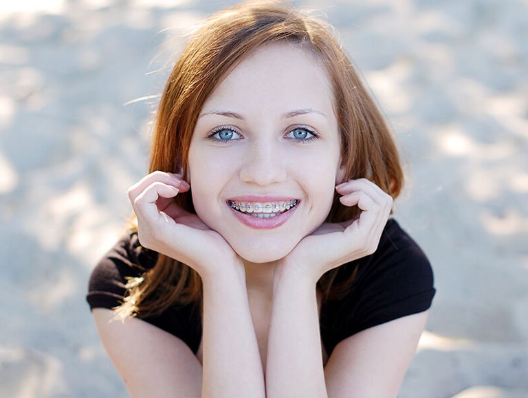 Propel Orthodontics and Its Advantages - Stratford Tooth Implants Propel Orthodontics and Its Advantages - Stratford Tooth Implants